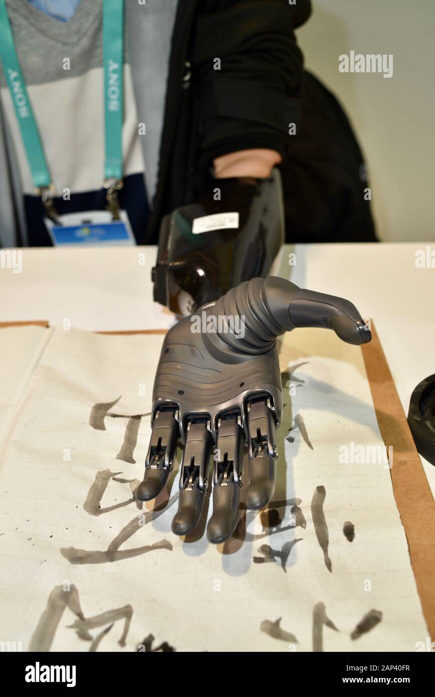 BrainCo prothetischer Arm und Hand mit künstlicher Intelligenz und ... BrainCo prothetischer Arm und Hand mit künstlicher Intelligenz und ...