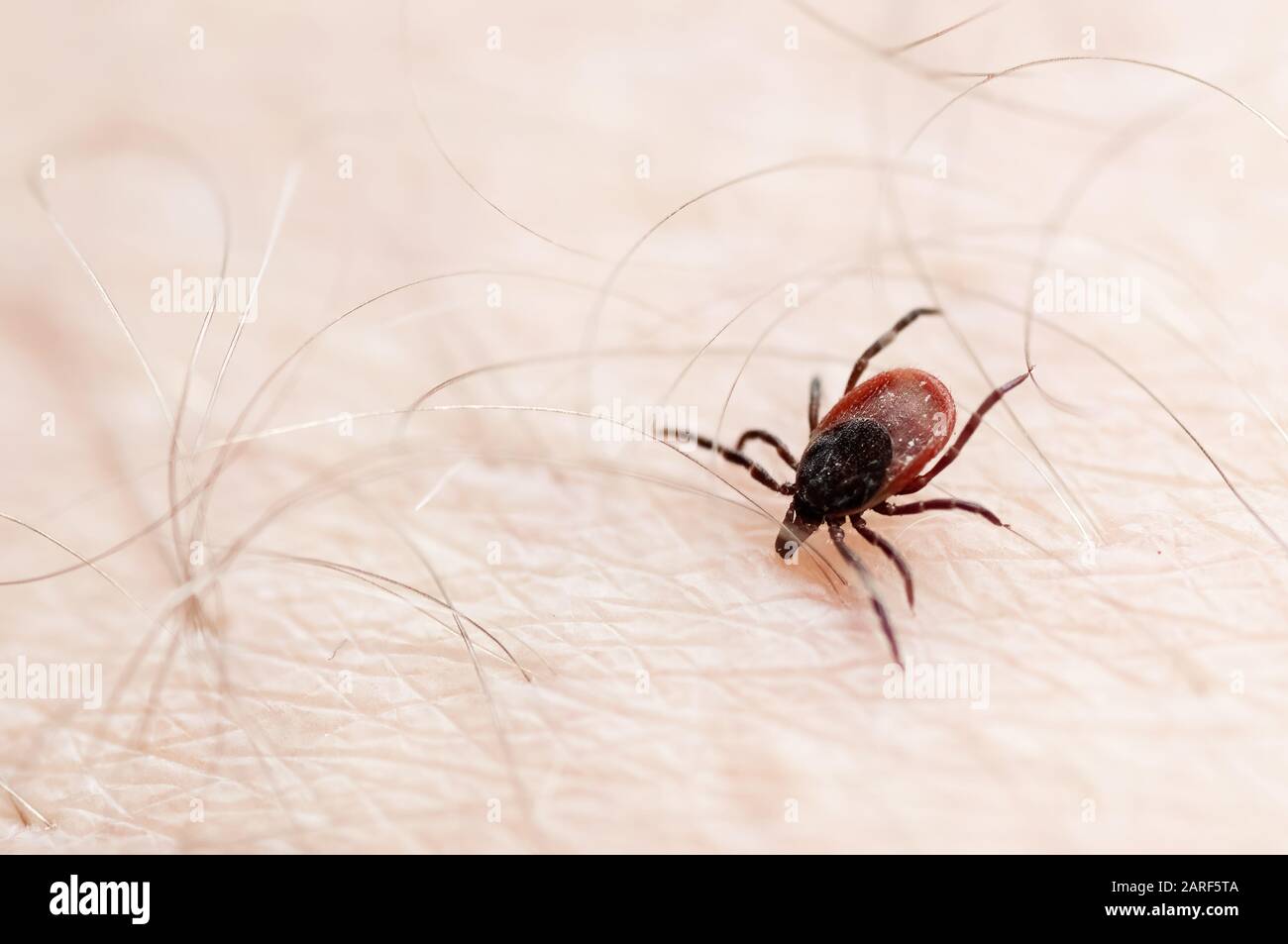 Hautparasiten mensch -Fotos und -Bildmaterial in hoher Auflösung – Alamy