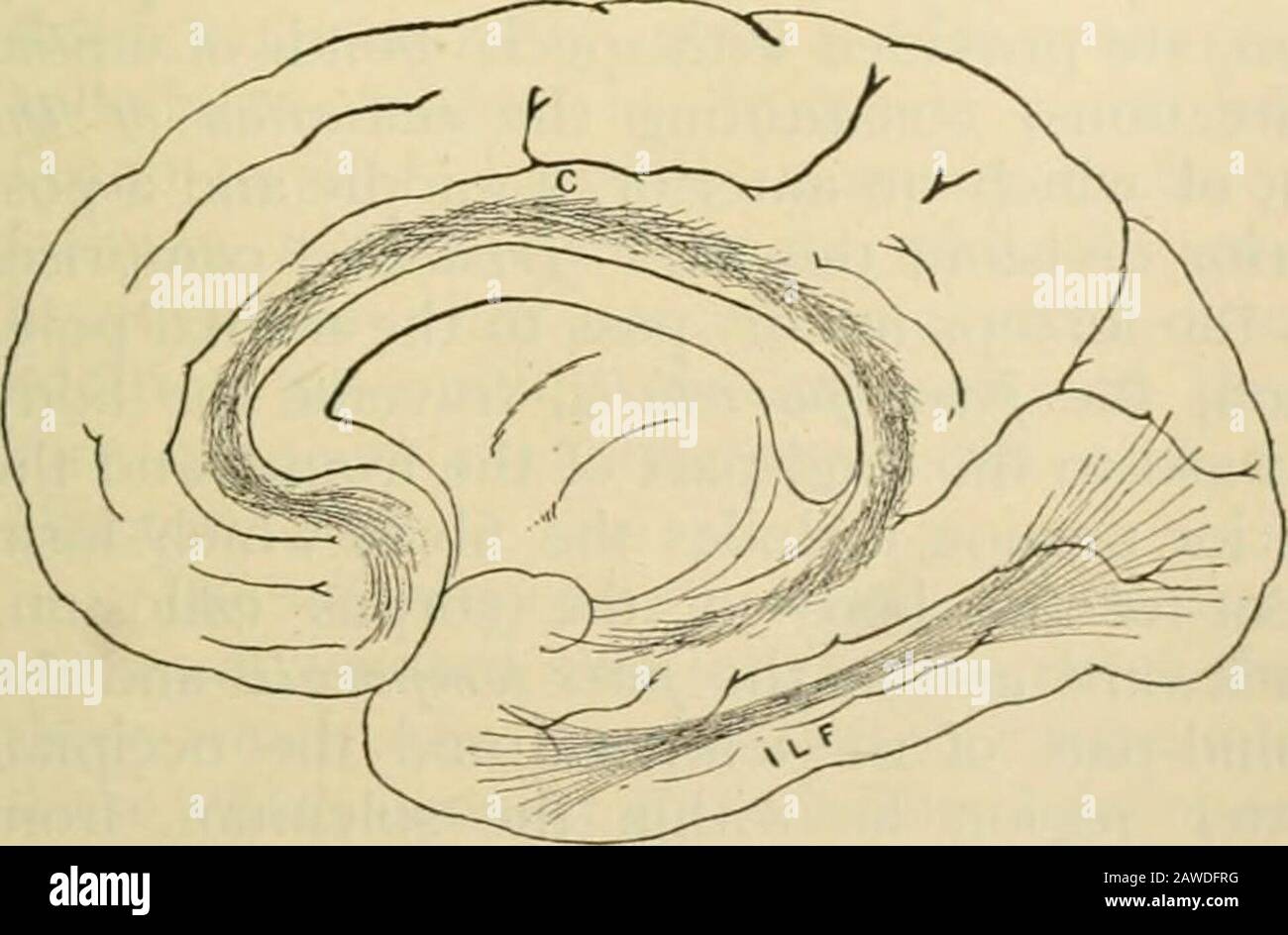 Gyrus temporalis superior -Fotos und -Bildmaterial in hoher Auflösung ...