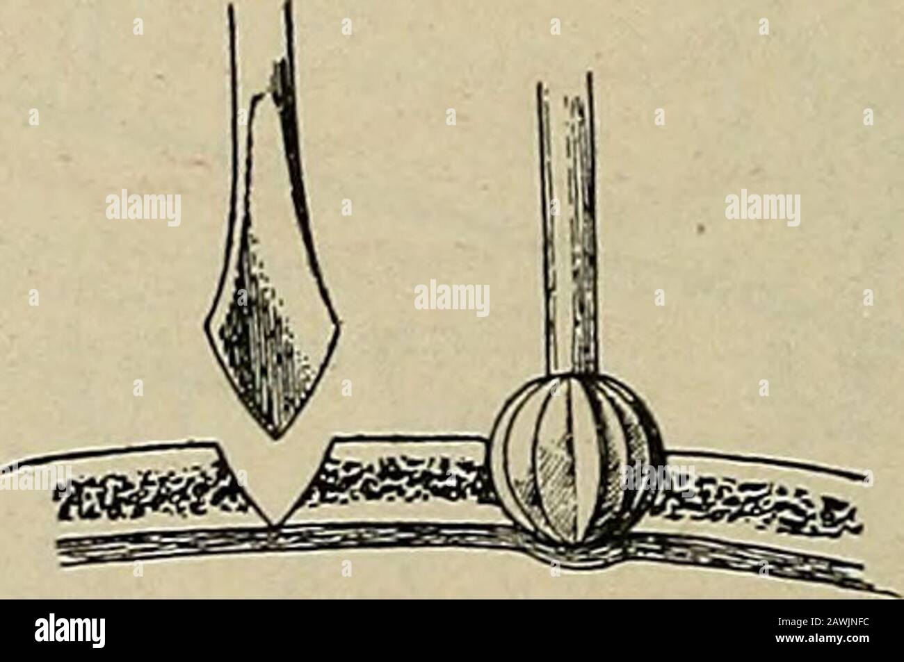 Gyrus angularis -Fotos und -Bildmaterial in hoher Auflösung – Alamy