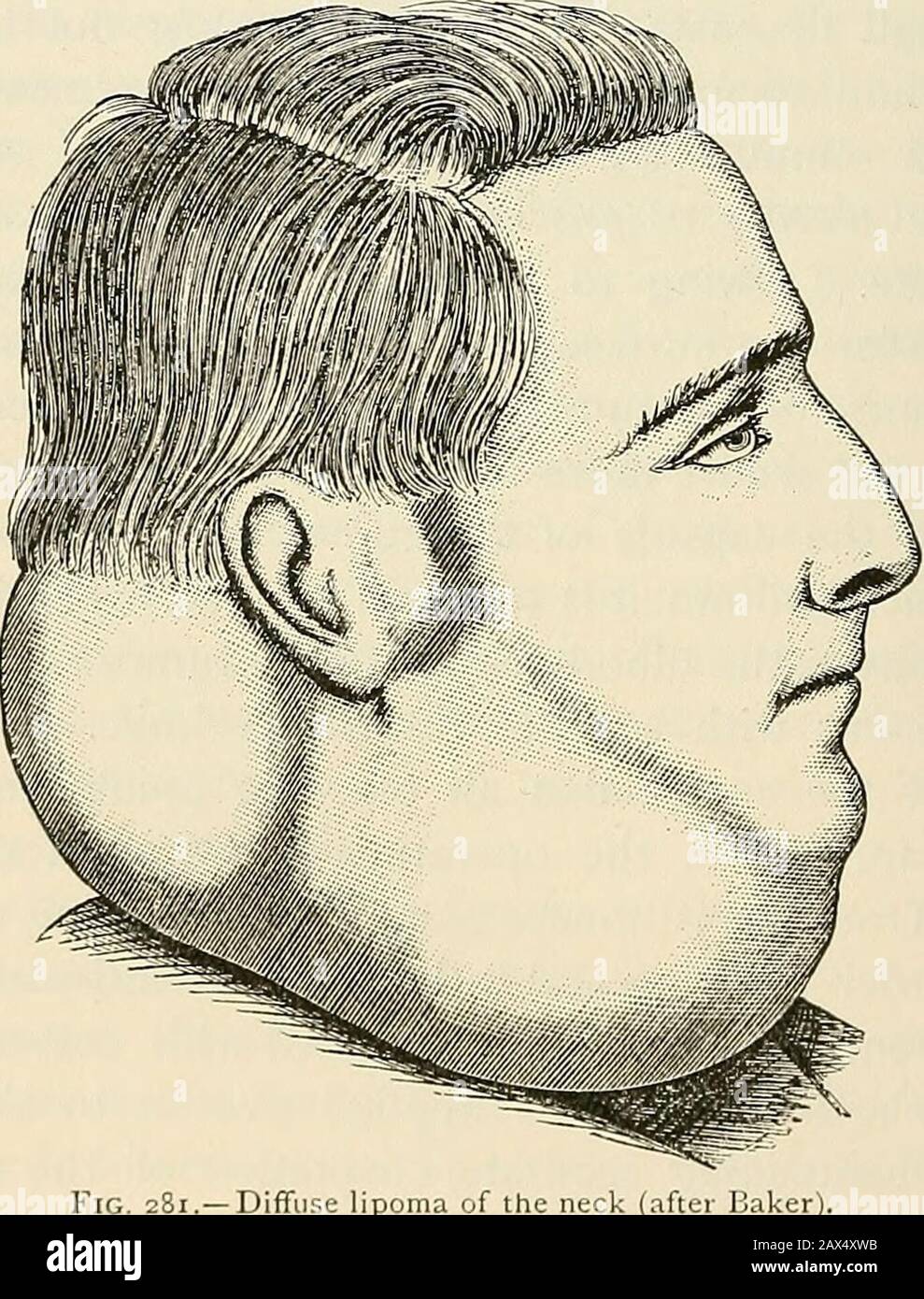 Die Pathologie und chirurgische Behandlung von Tumoren . ltant oder ...