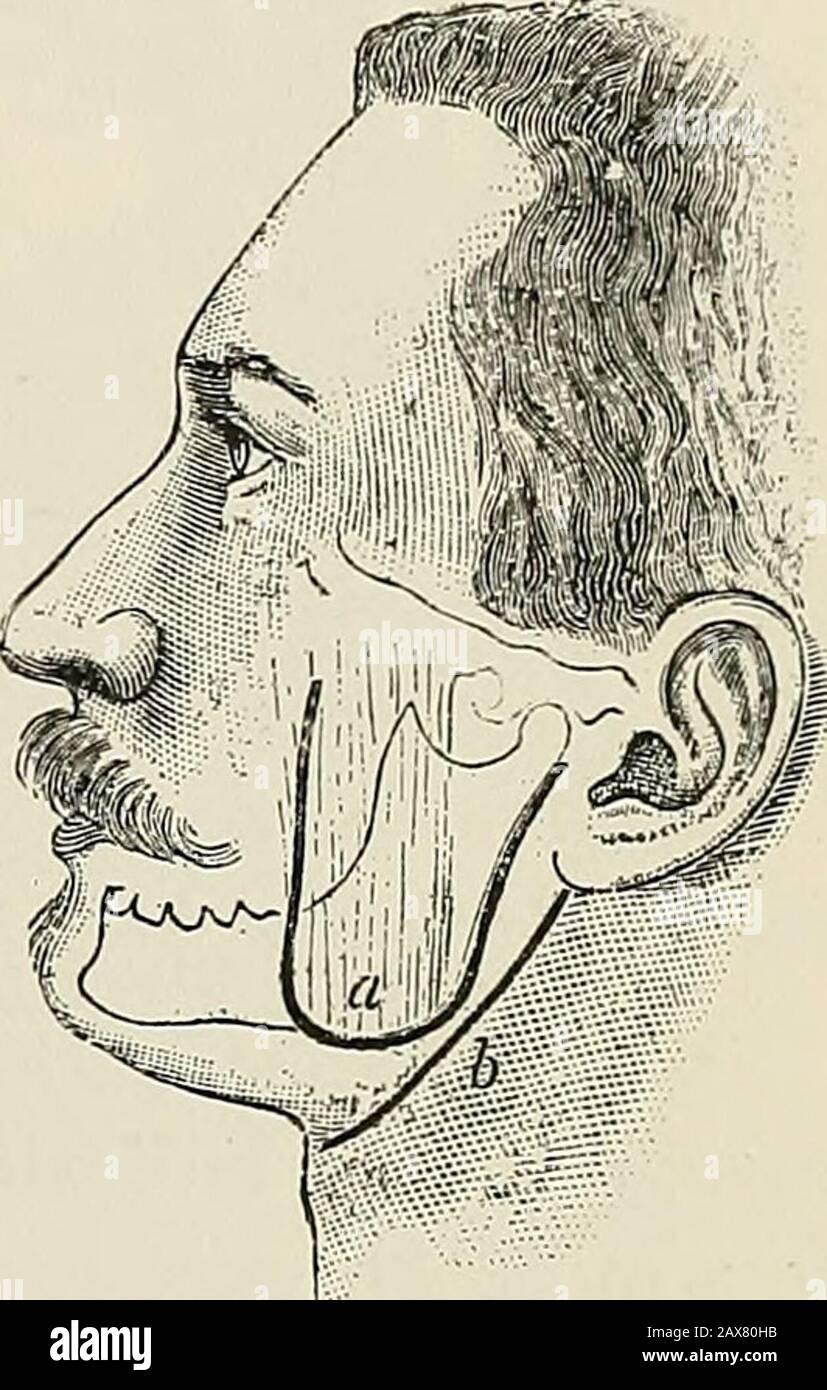 Die Pathologie und chirurgische Behandlung von Tumoren . die Krankheit ...
