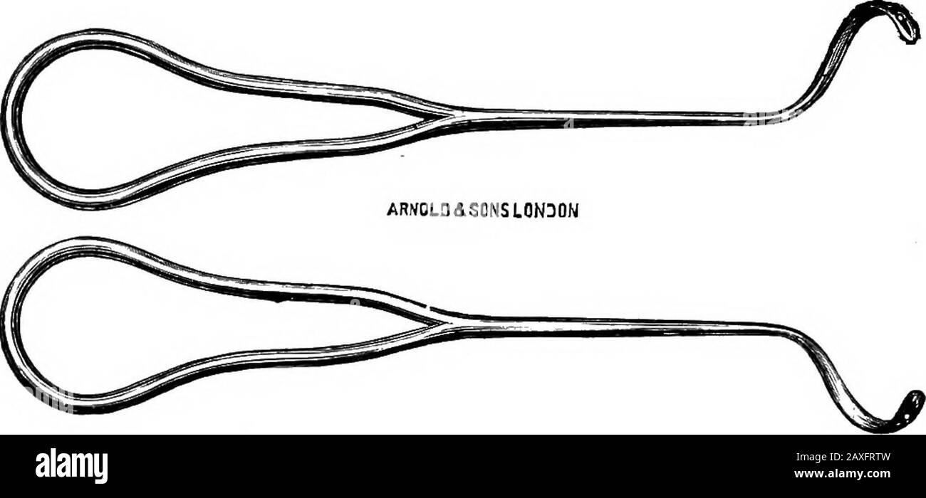 Hernia inguinal femoral -Fotos und -Bildmaterial in hoher Auflösung – Alamy