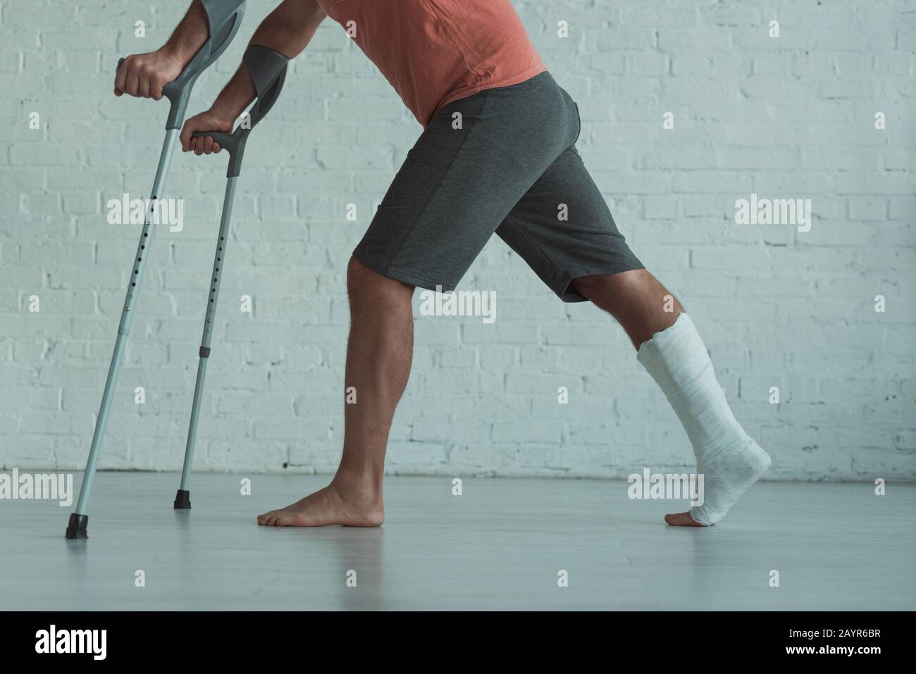 Gipsbein Verletzung Mann Stockfotos und -bilder Kaufen - Alamy