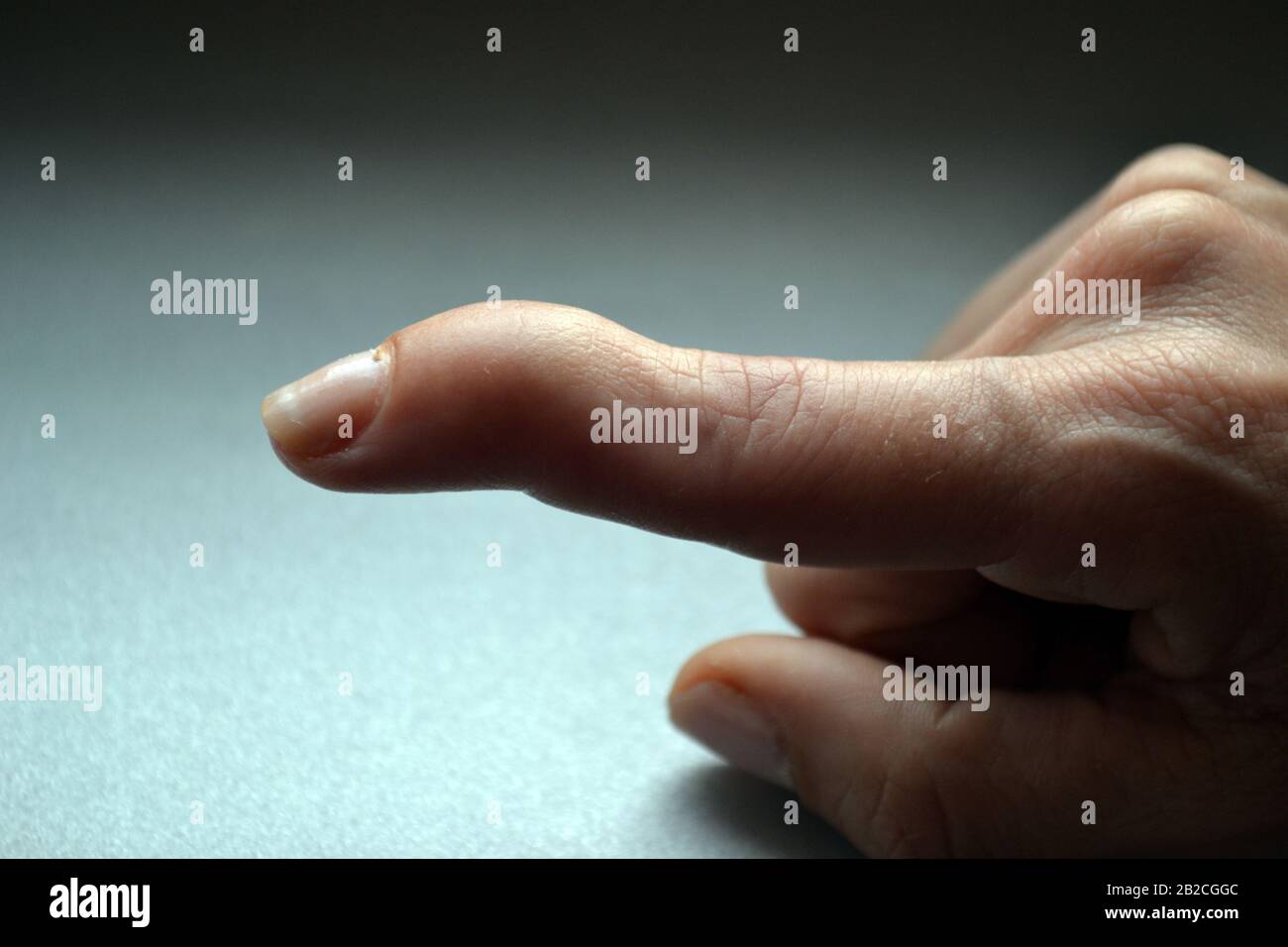 Verformung der finger -Fotos und -Bildmaterial in hoher Auflösung – Alamy