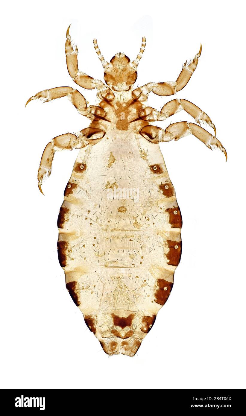 Weibliche kopflaus -Fotos und -Bildmaterial in hoher Auflösung – Alamy