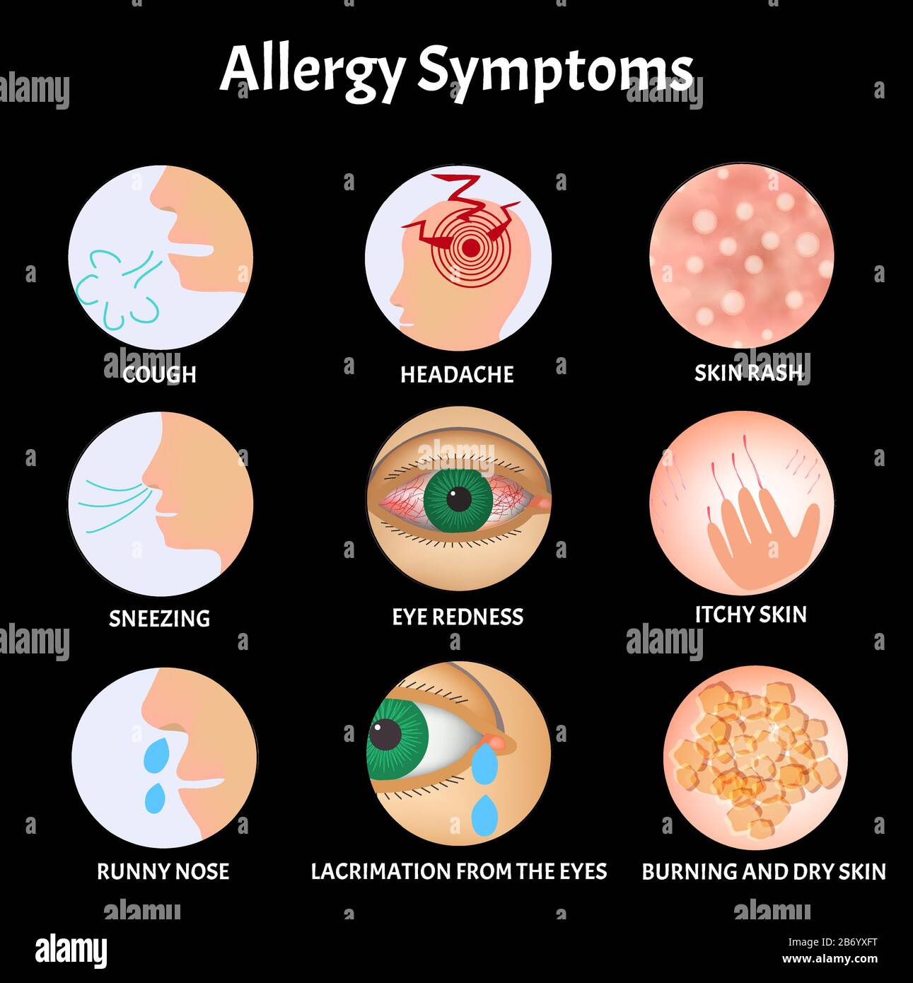 Schne Allergie Grser Symptome Bilder
