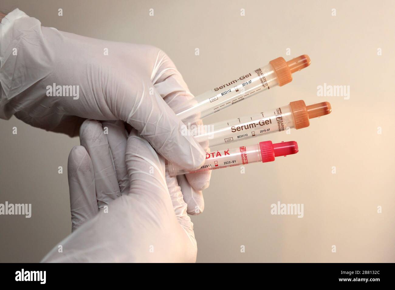 Blutserum röhrchen -Fotos und -Bildmaterial in hoher Auflösung – Alamy