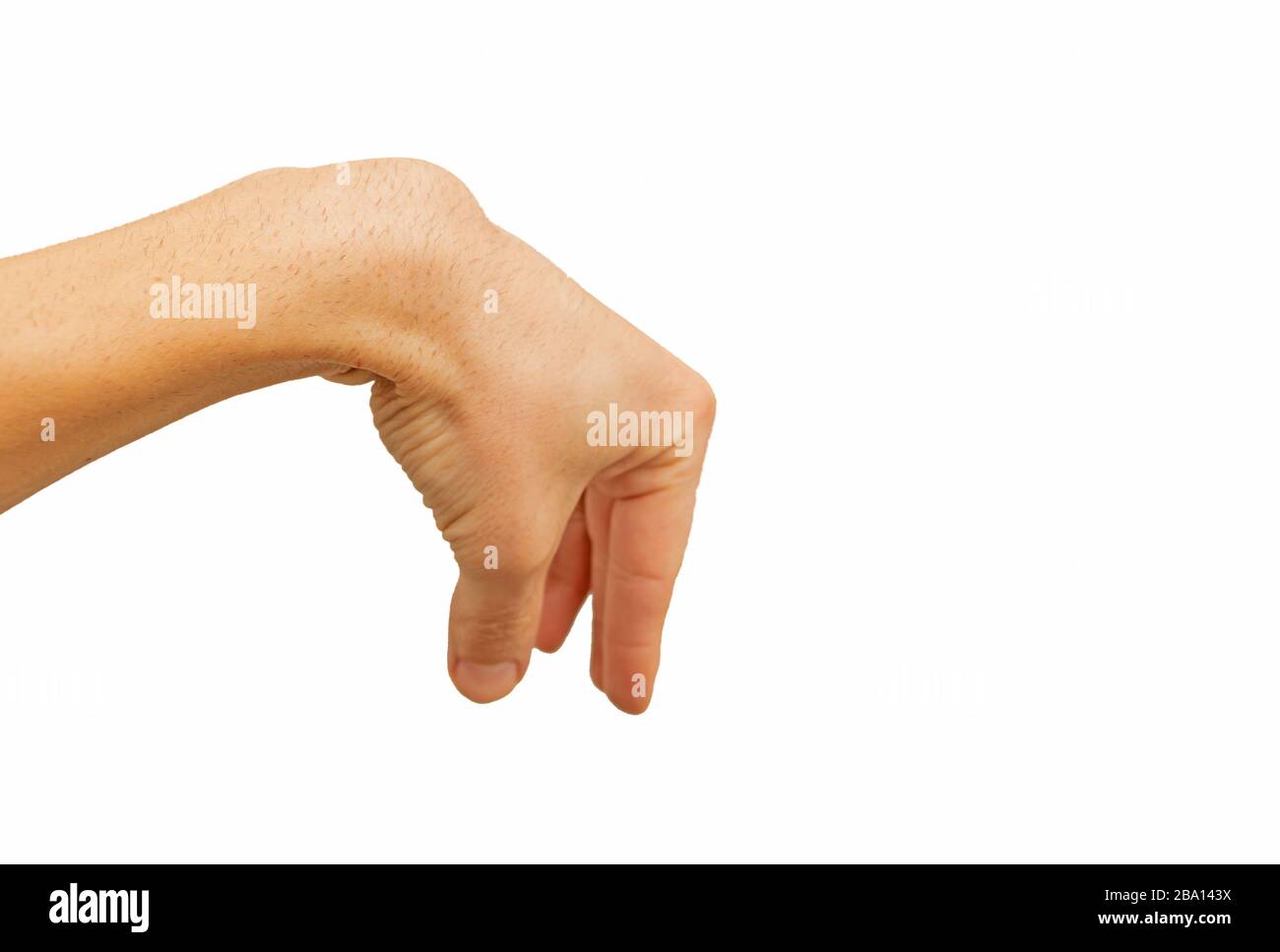 Ganglion cysts -Fotos und -Bildmaterial in hoher Auflösung – Alamy