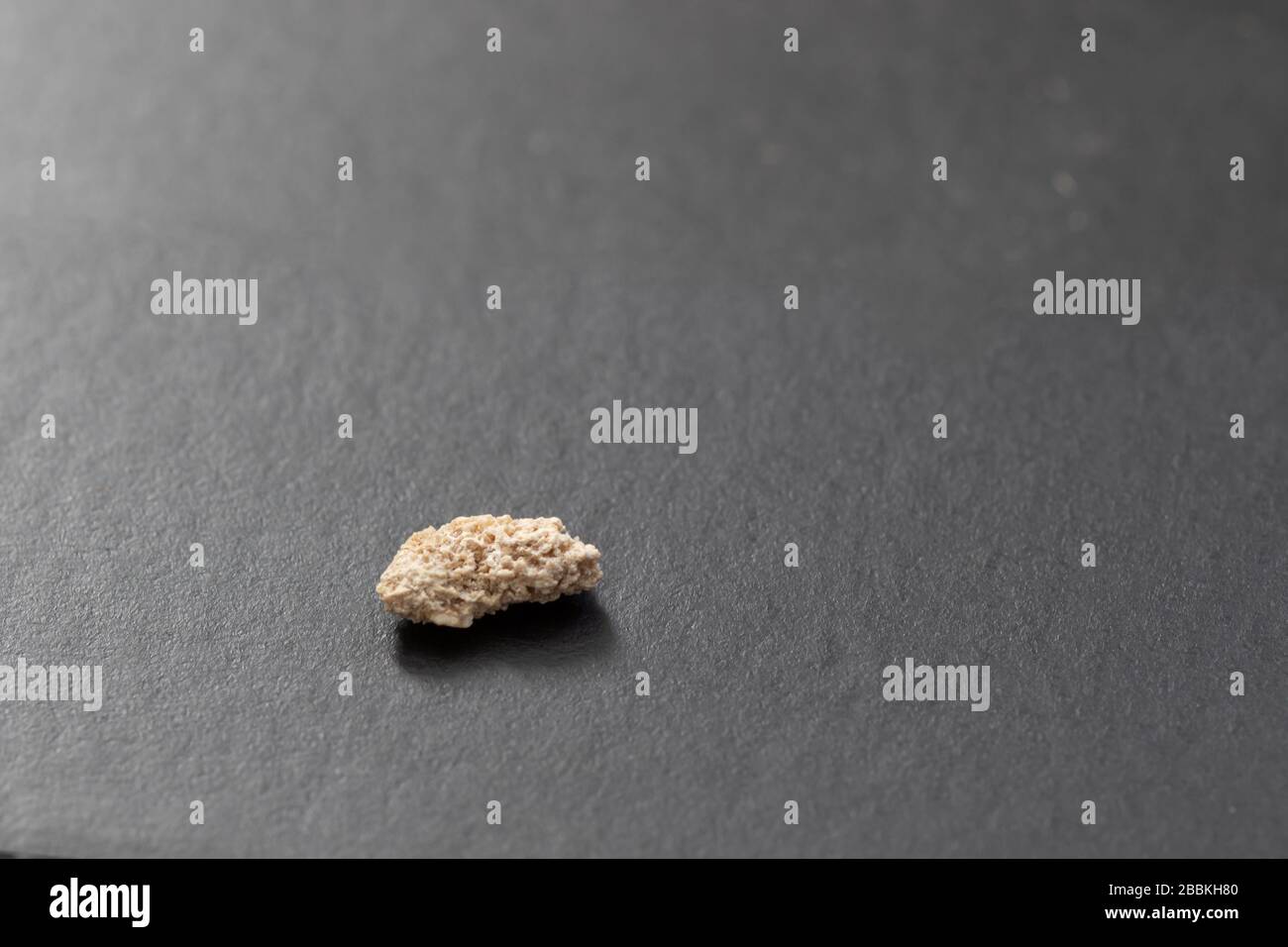 Kidney disorder -Fotos und -Bildmaterial in hoher Auflösung – Alamy