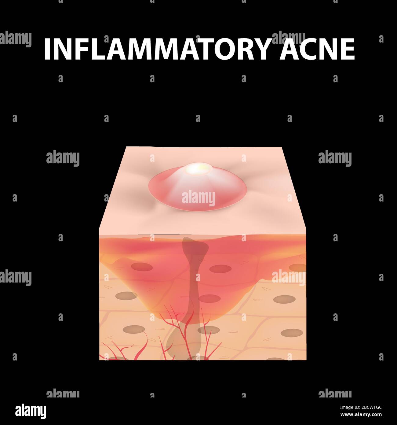 Dermatologische Creme Stockfotos und -bilder Kaufen - Alamy