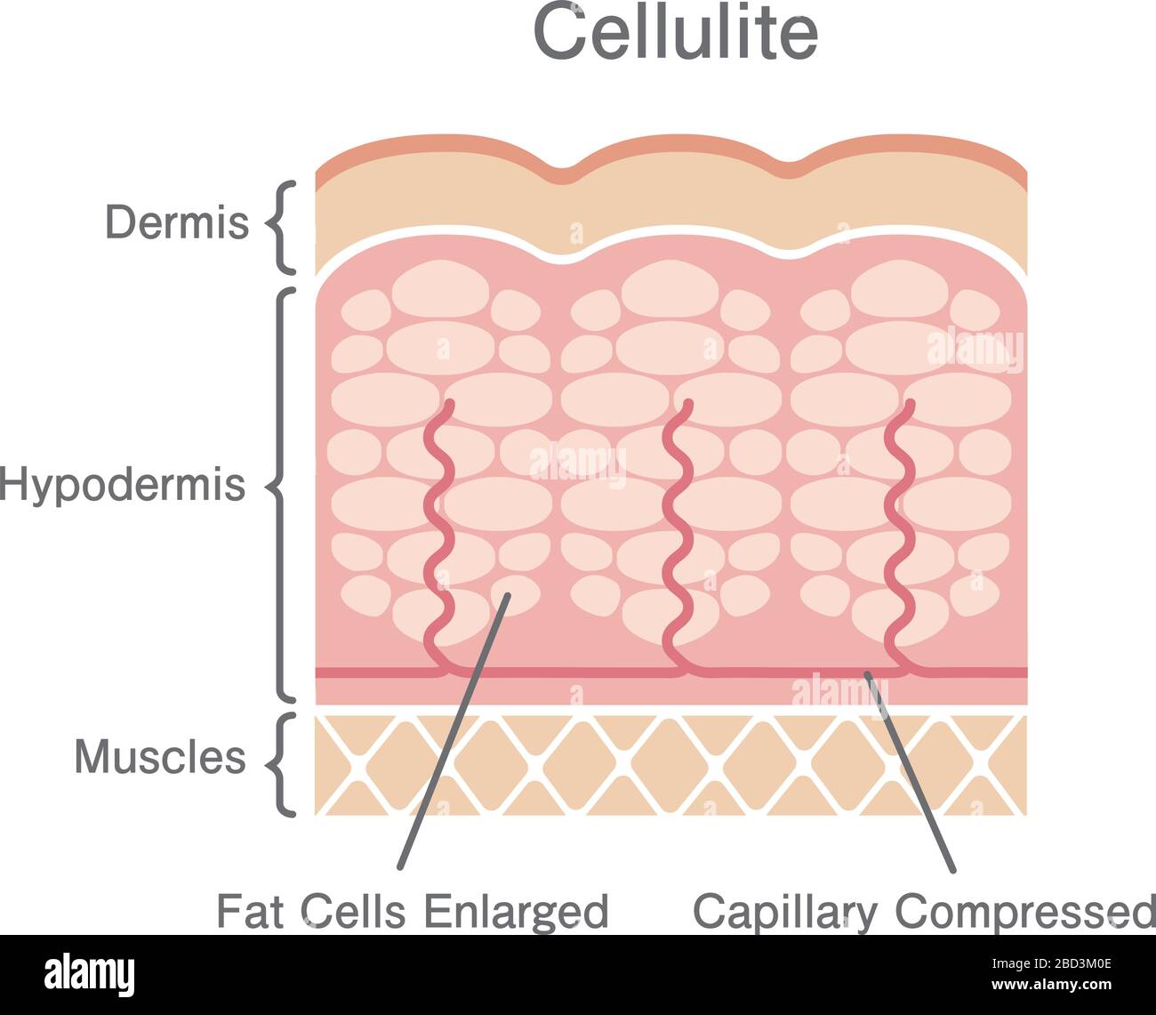 Human skin diagram Stock-Vektorgrafiken kaufen - Seite 3 - Alamy