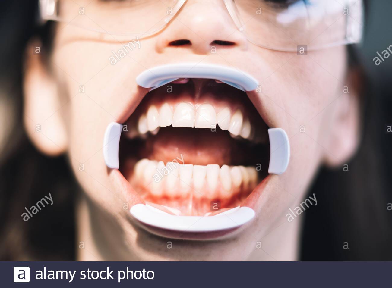 Wide Open Mouth Dentist Stockfotos & Wide Open Mouth Dentist Bilder - Alamy