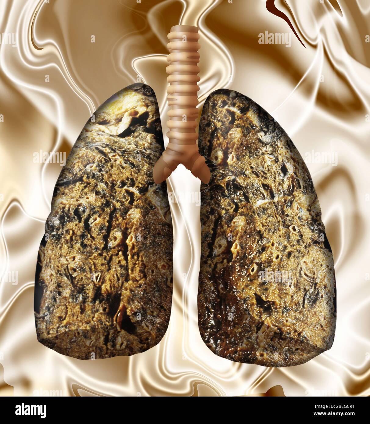 Raucher lungen -Fotos und -Bildmaterial in hoher Auflösung – Alamy