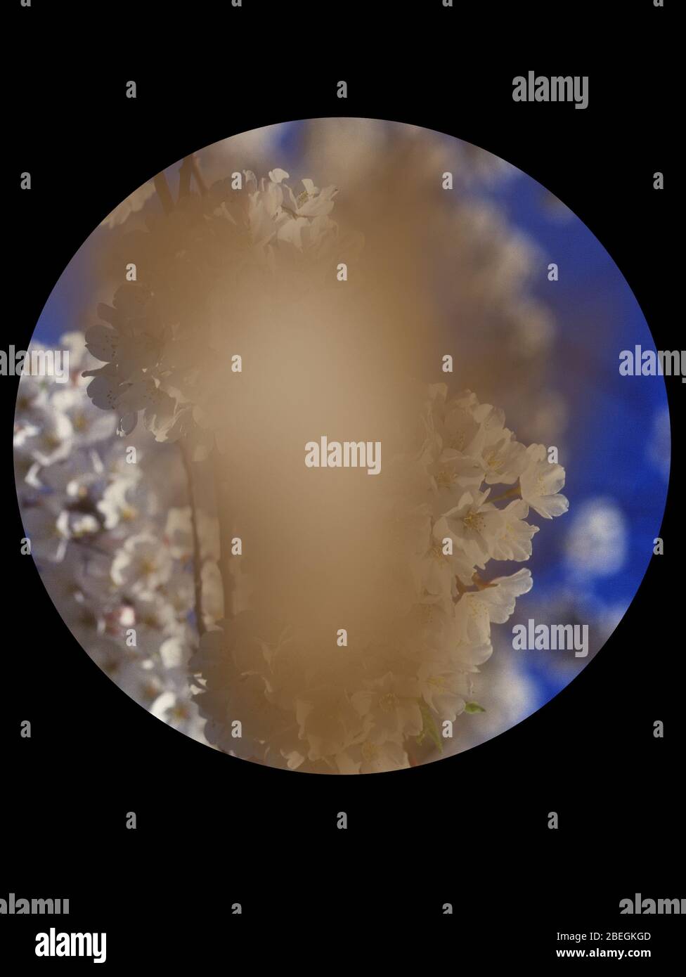 Auge katarakte -Fotos und -Bildmaterial in hoher Auflösung – Alamy