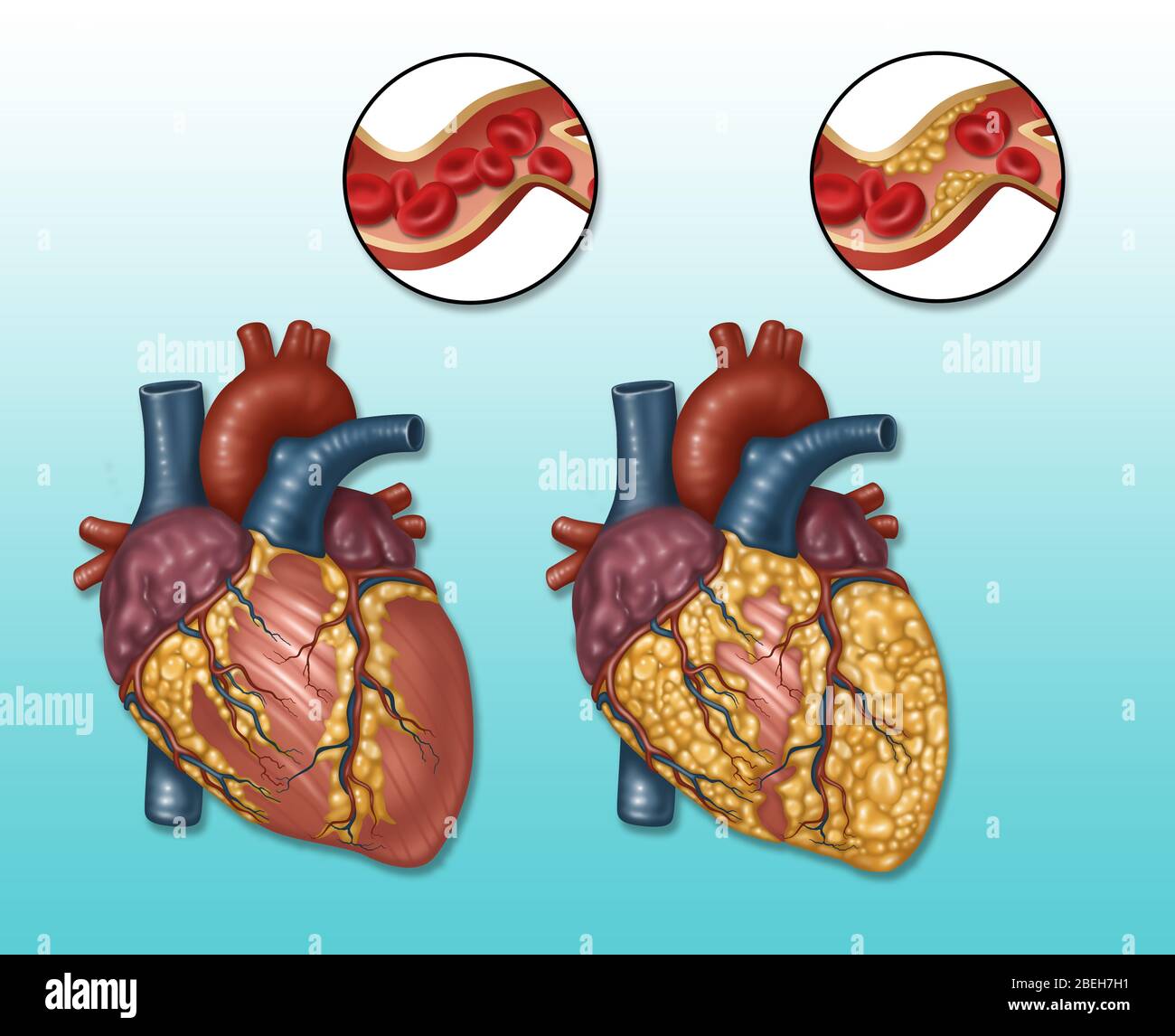 Herz und arterie -Fotos und -Bildmaterial in hoher Auflösung – Alamy