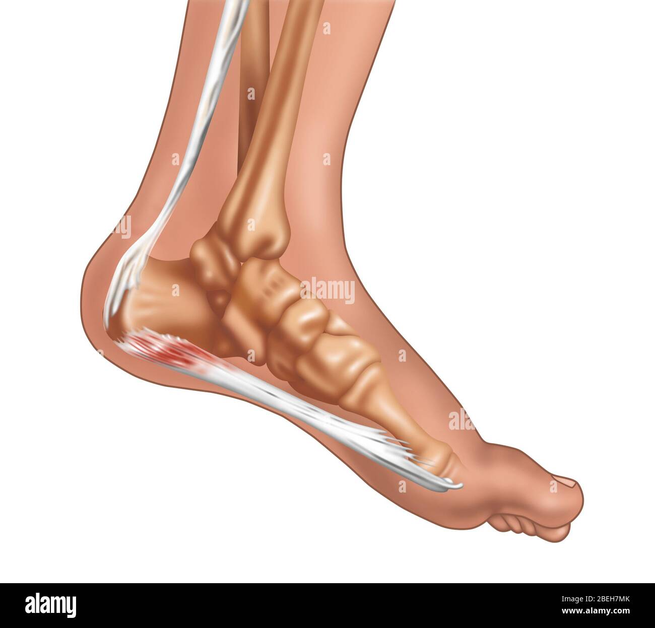 Fuß plantarfaszie illustration -Fotos und -Bildmaterial in hoher ...