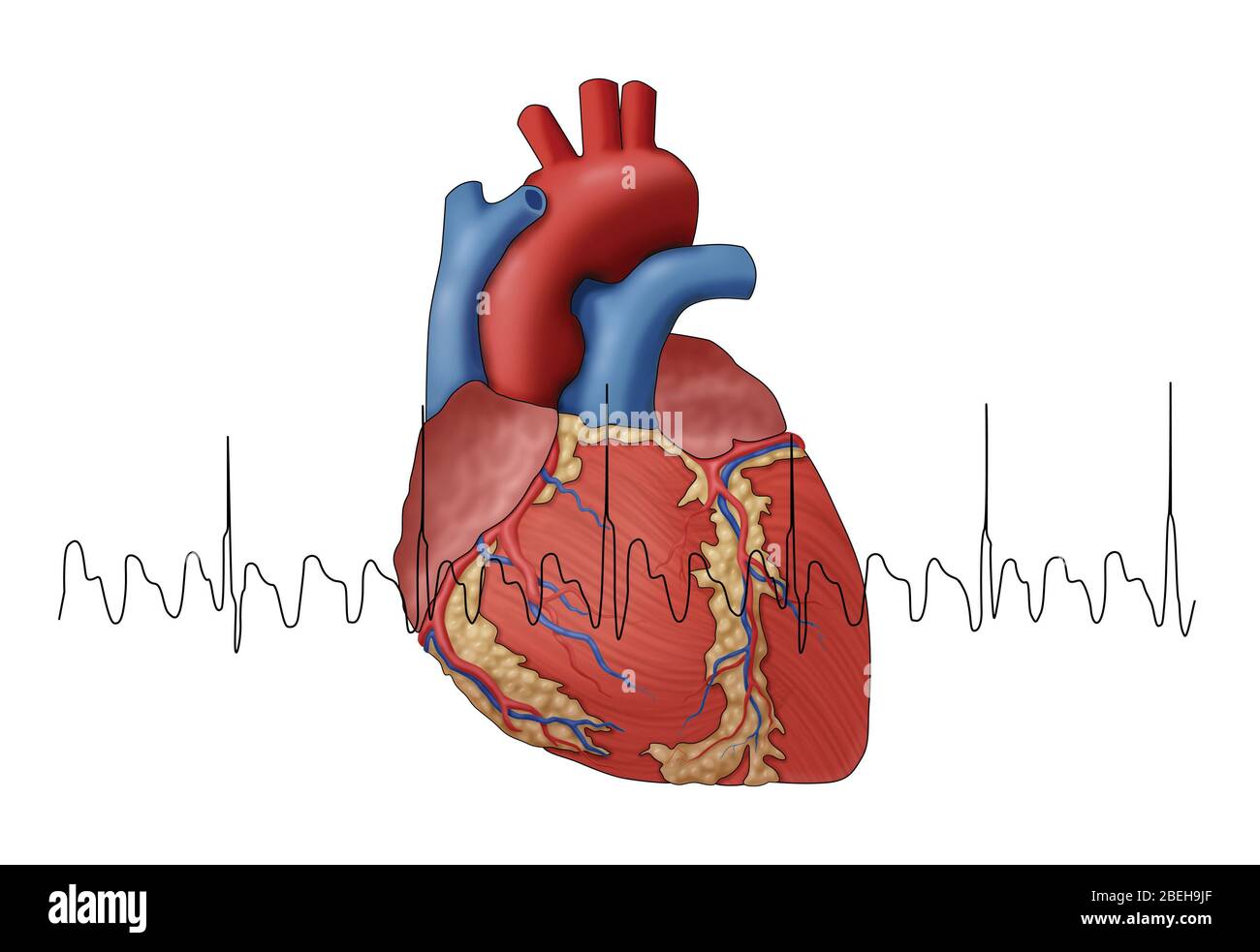 Vorhofflattern mit EKG, Illustration Stockfotografie - Alamy