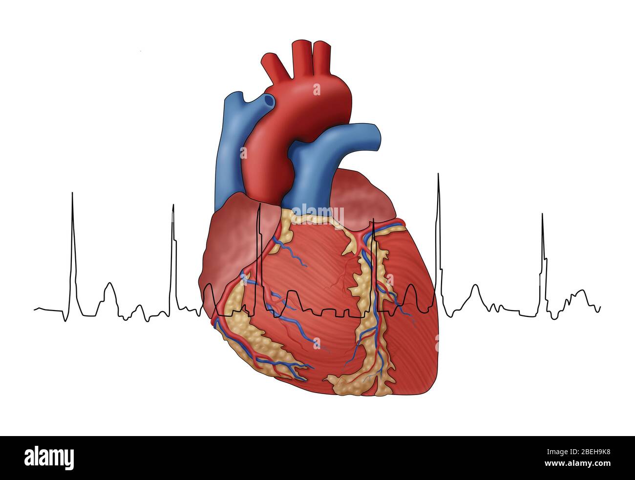 Vorhofflimmern mit EKG, Illustration Stockfotografie - Alamy