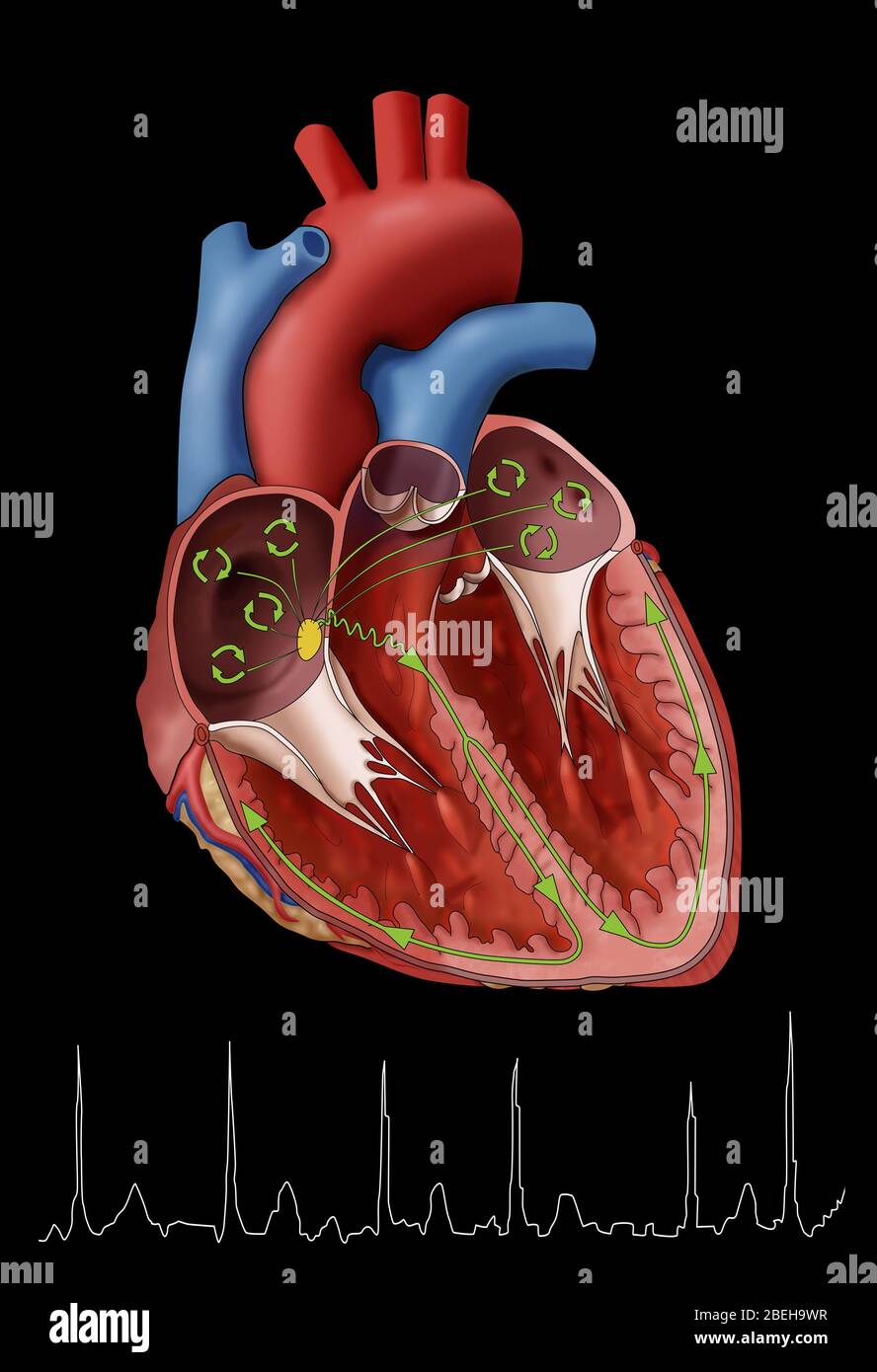 Vorhofflimmern ekg -Fotos und -Bildmaterial in hoher Auflösung – Alamy