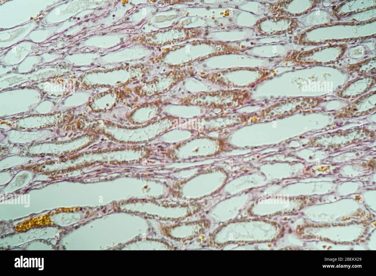 Healthy lung tissue -Fotos und -Bildmaterial in hoher Auflösung – Alamy