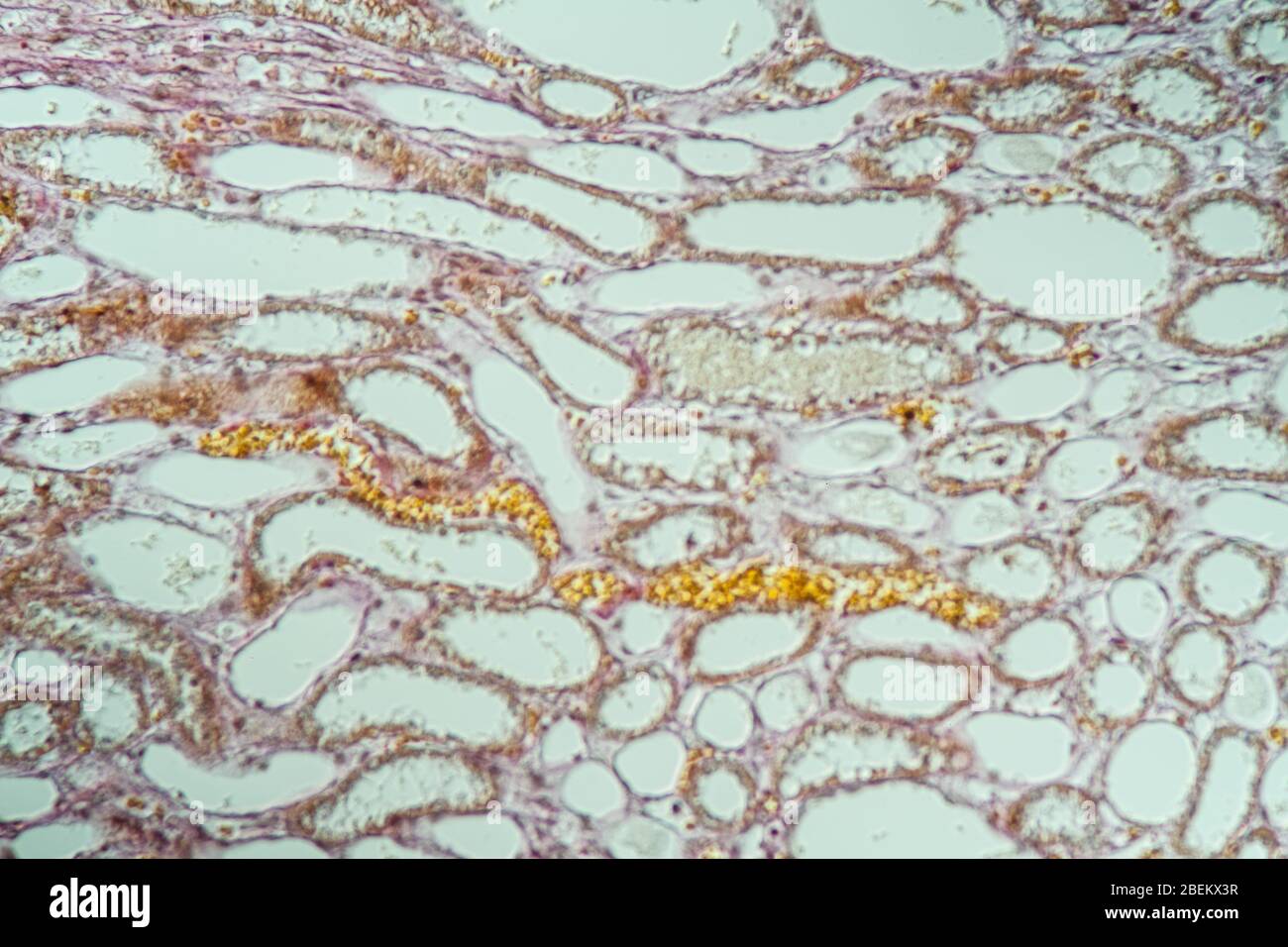 Healthy lung tissue -Fotos und -Bildmaterial in hoher Auflösung – Alamy