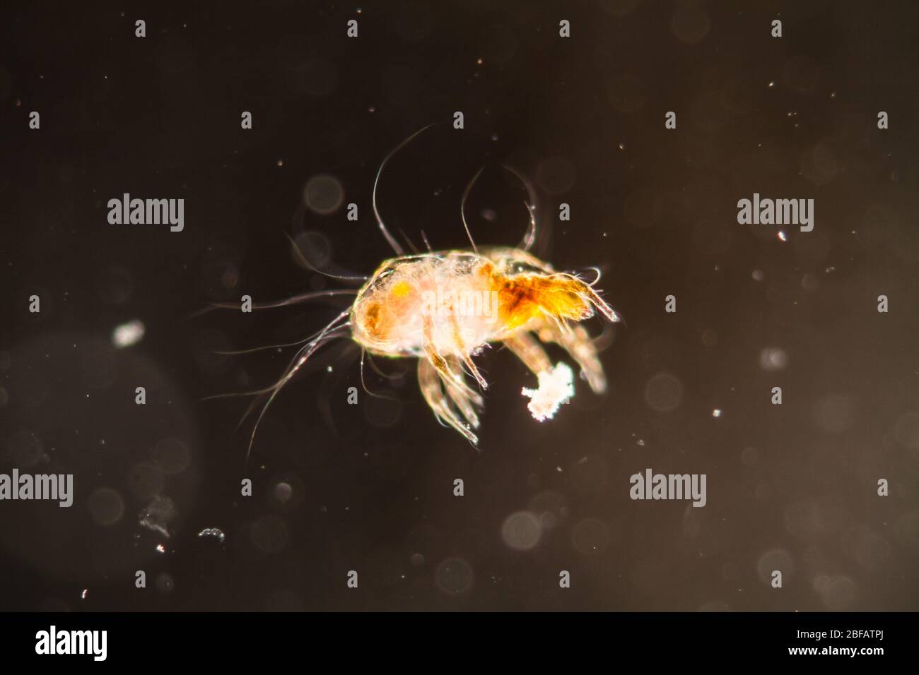 Hausstaubmilbe unter dem Mikroskop 100x Stockfotografie - Alamy