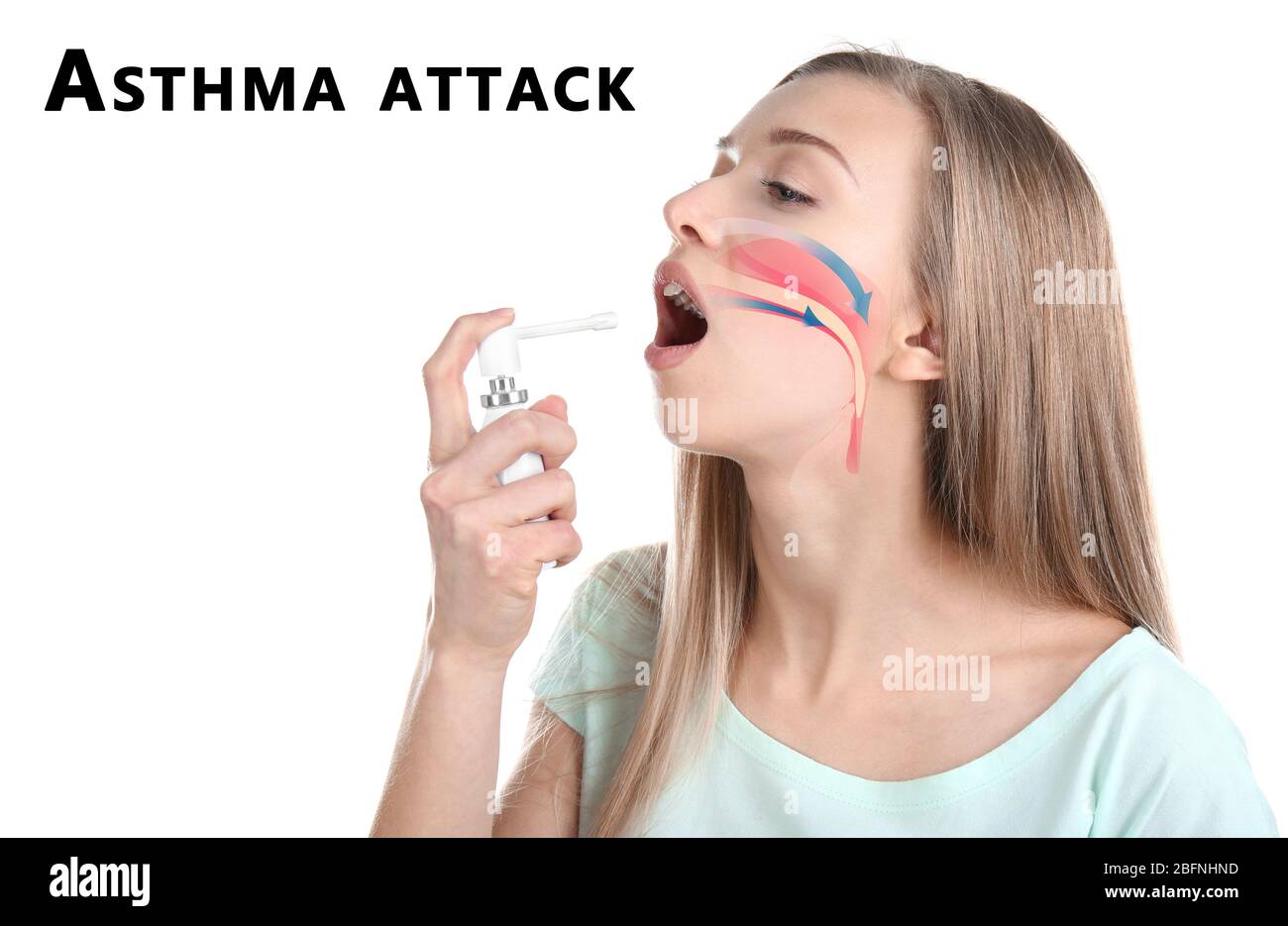 The anatomy of an asthma attack -Fotos und -Bildmaterial in hoher ...