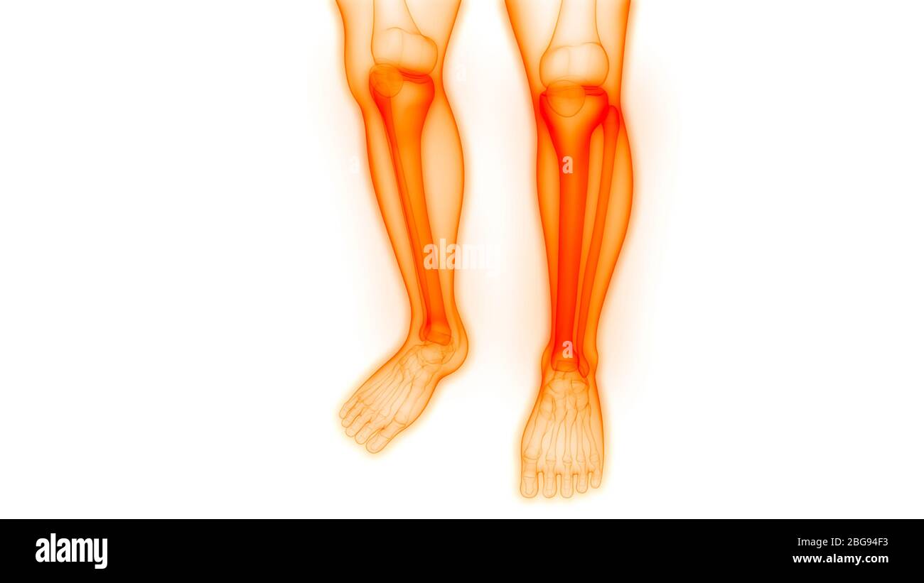 Anatomie der Knochen von Knochen an der Tibia und der Fibula ...