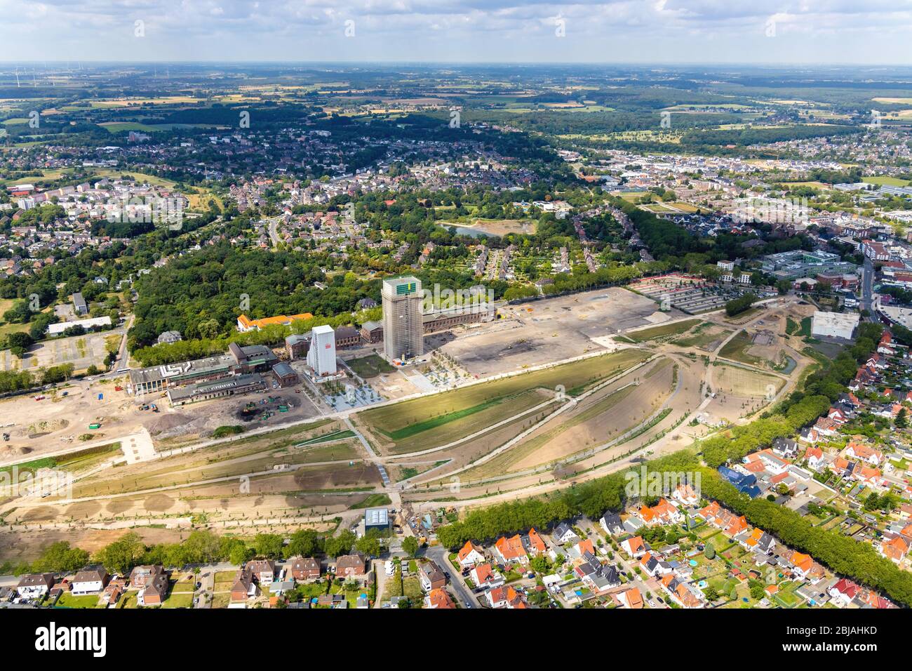 What Is Stage 3 Emphysema