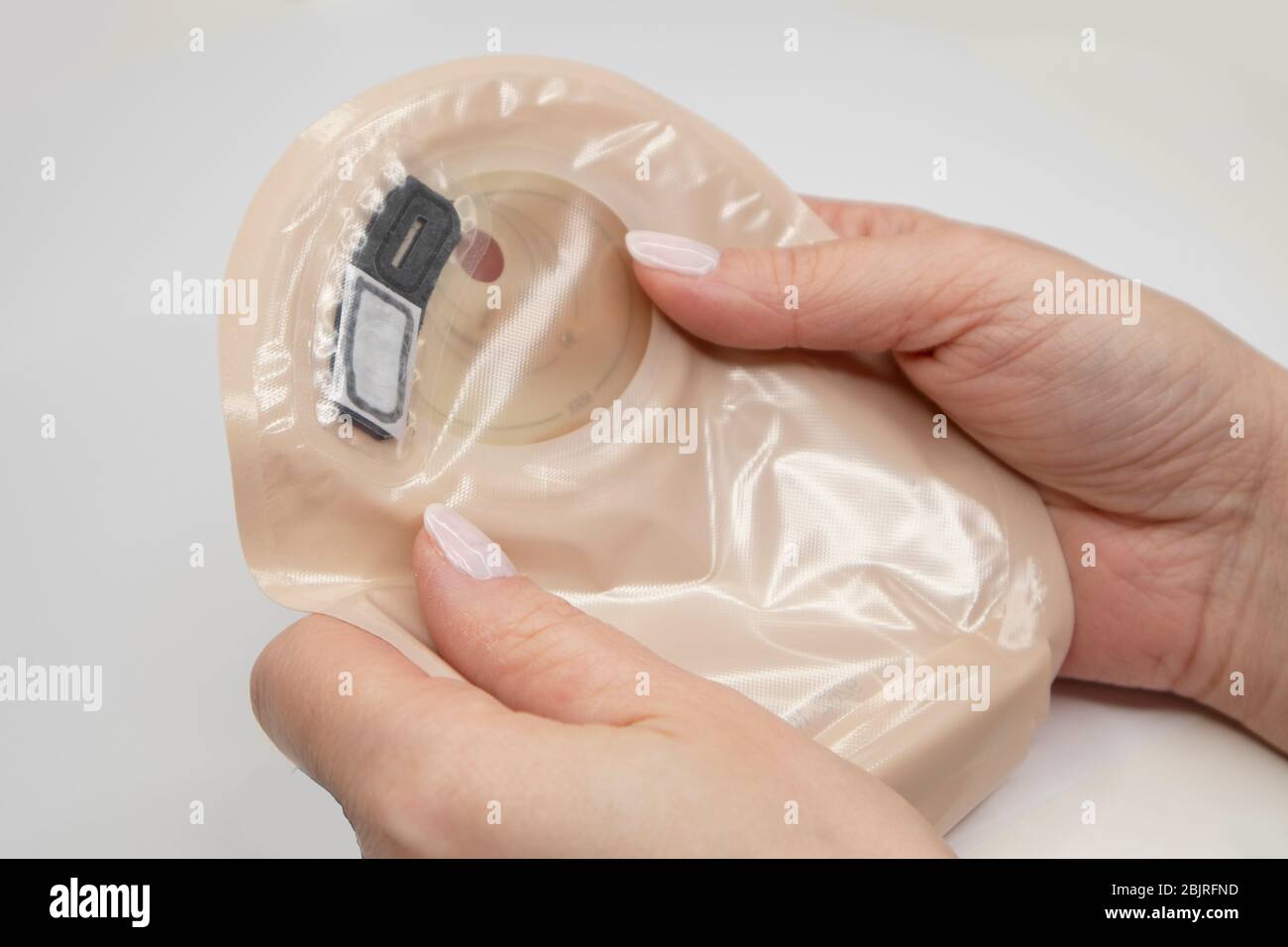Draufsicht auf Kolostomie Tasche benötigt nach Kolostomie Chirurgie ...