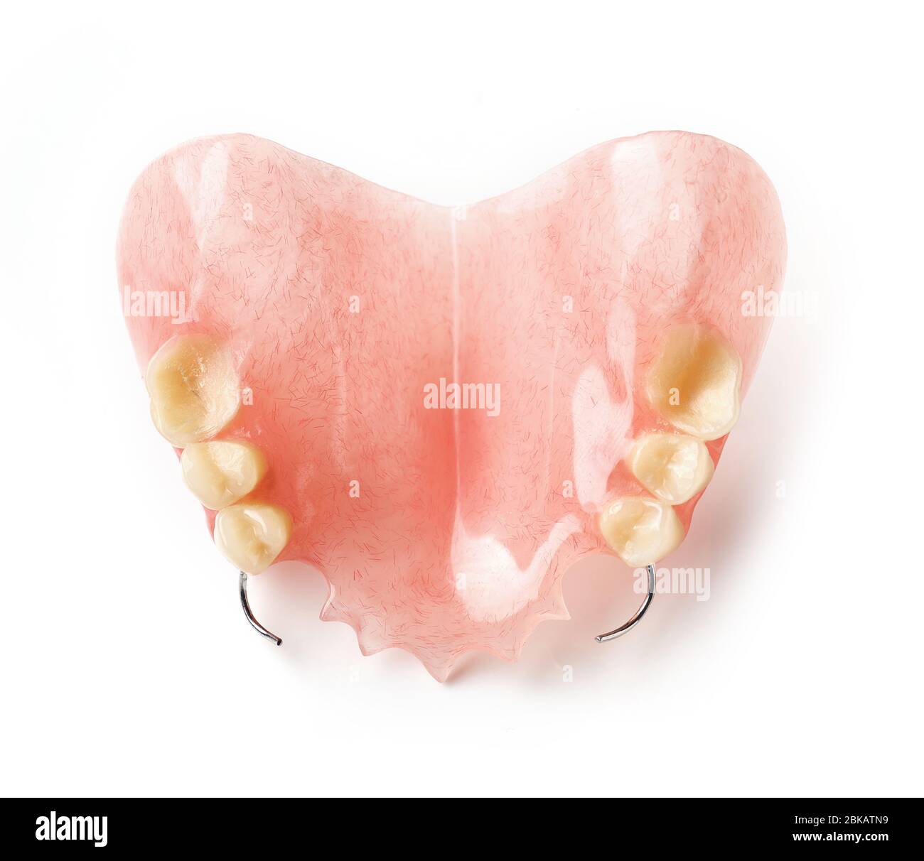 Herausnehmbare teilprothese -Fotos und -Bildmaterial in hoher Auflösung ...