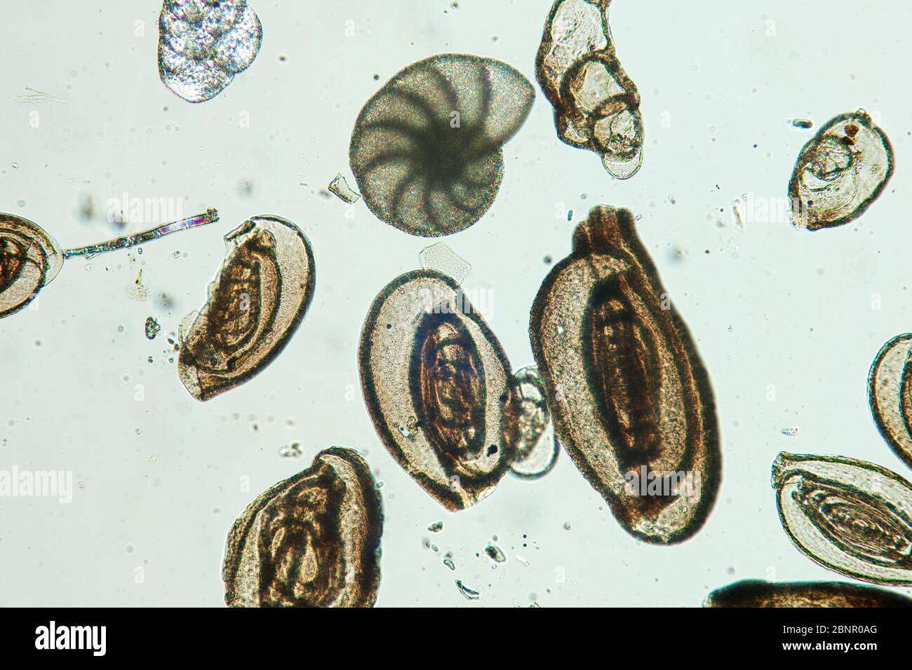 Foraminifera ameboid protists aus der Adria, photomicrograph in ...
