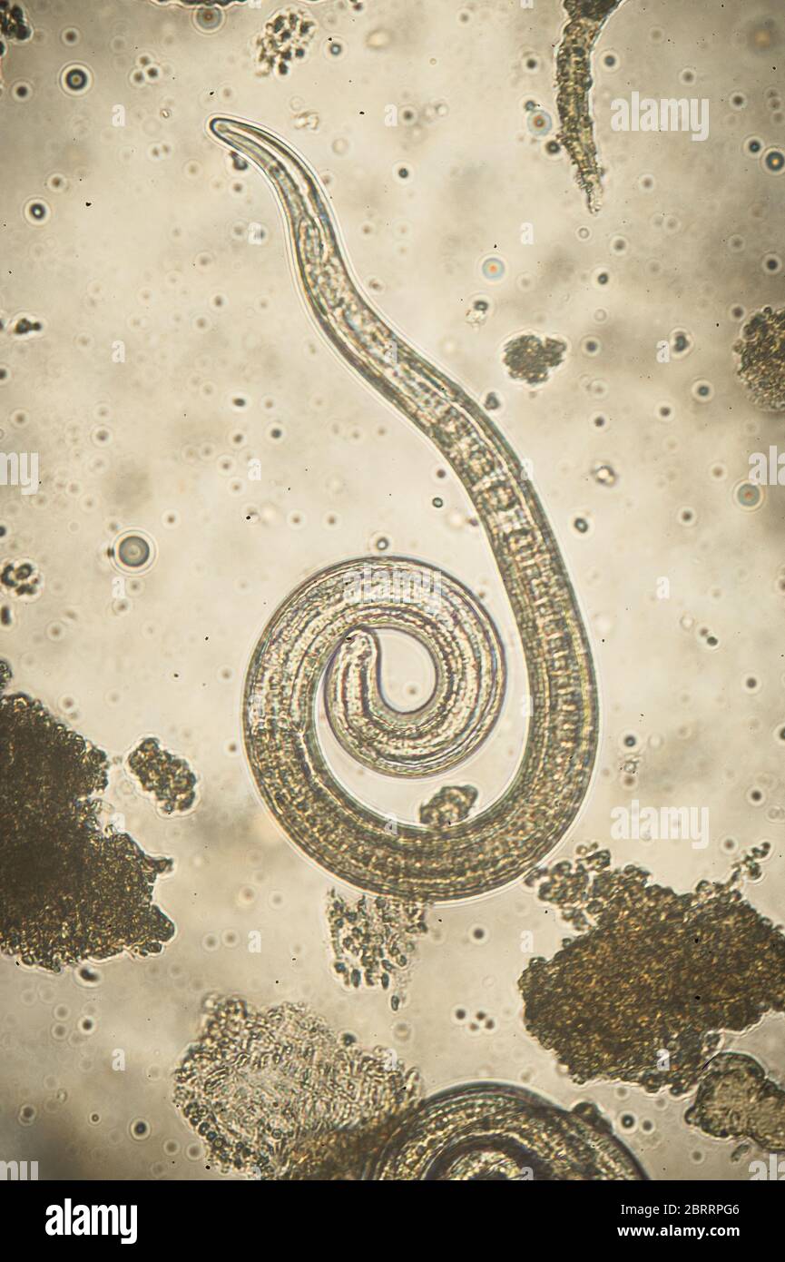 Trichinella spiralis - parasitäres nematoda-Wurmmikroskop ...