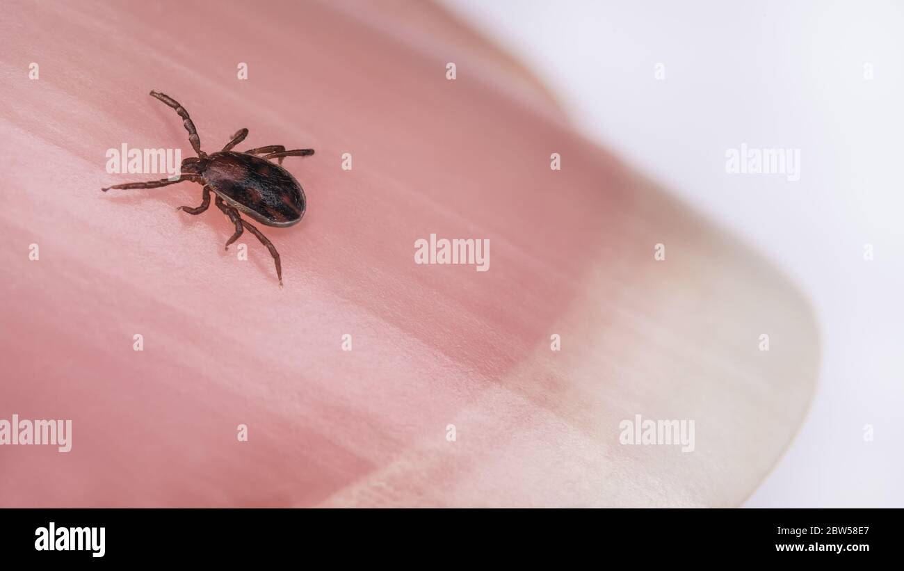 Nagel Detail mit kriechenden Hirsch Zecken Männchen. Ixodes ricinus ...