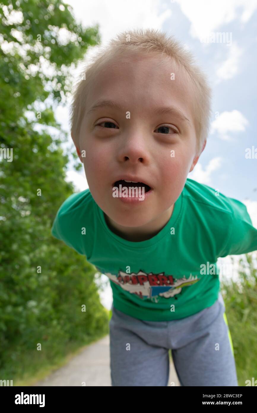 Boy with down syndrome -Fotos und -Bildmaterial in hoher Auflösung – Alamy