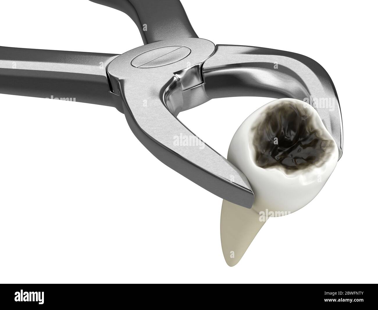 Extracting Tooth Stockfotos und -bilder Kaufen - Alamy