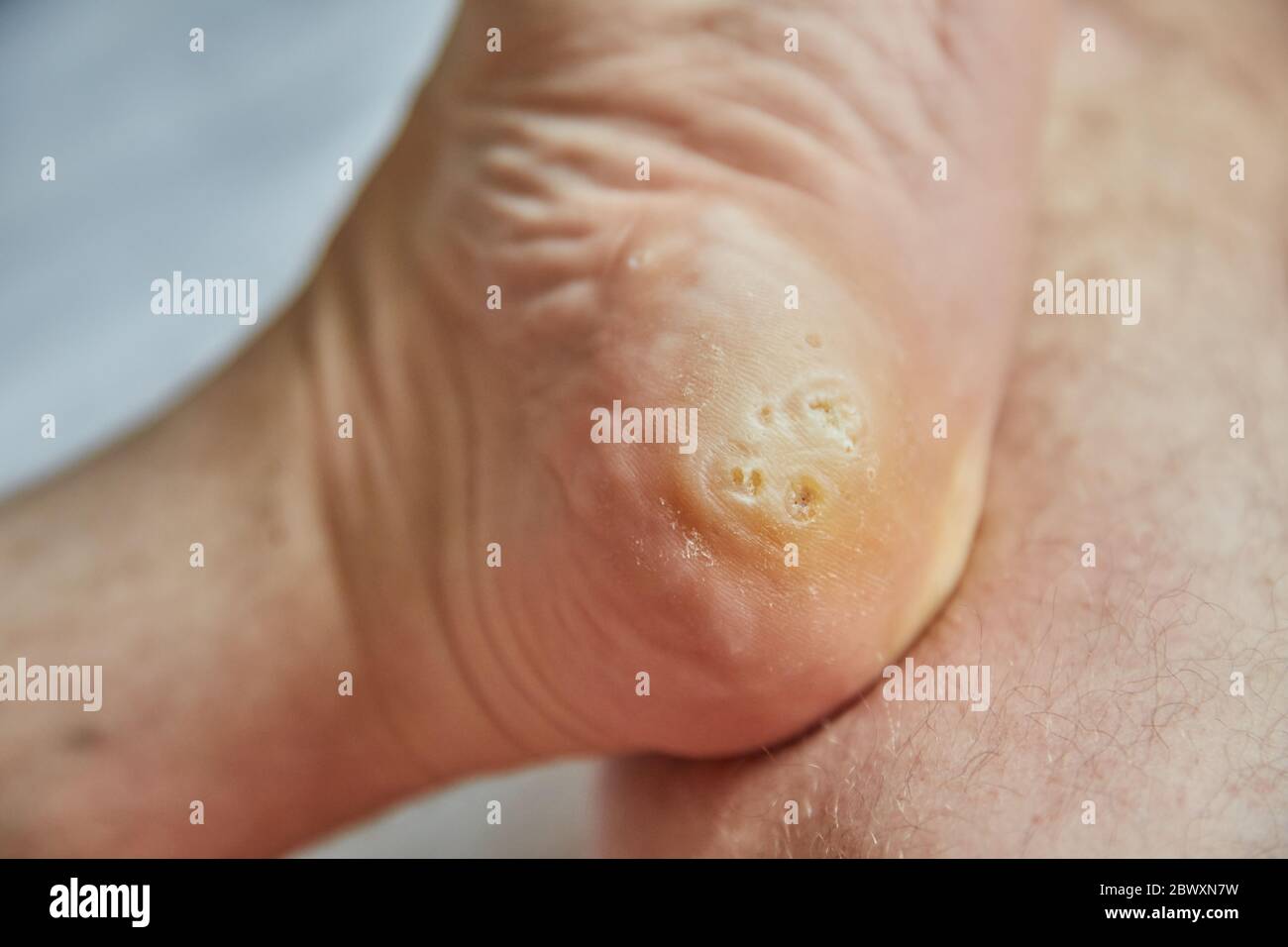 Dermatologe hautpflege -Fotos und -Bildmaterial in hoher Auflösung – Alamy