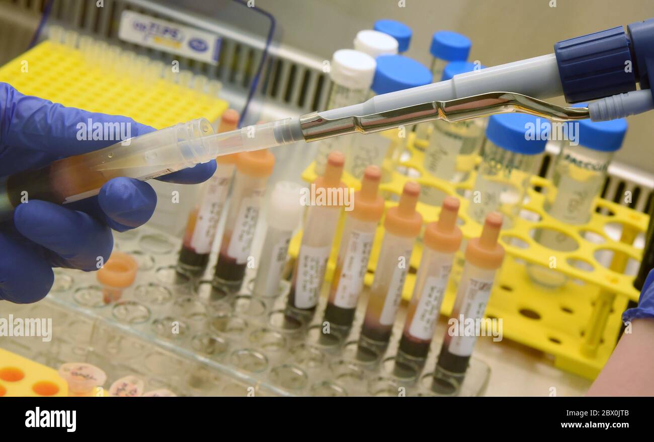 Blutserum röhrchen -Fotos und -Bildmaterial in hoher Auflösung – Alamy