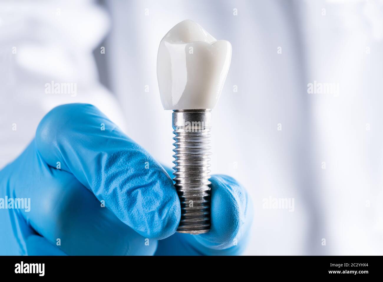 Implantat model -Fotos und -Bildmaterial in hoher Auflösung – Alamy