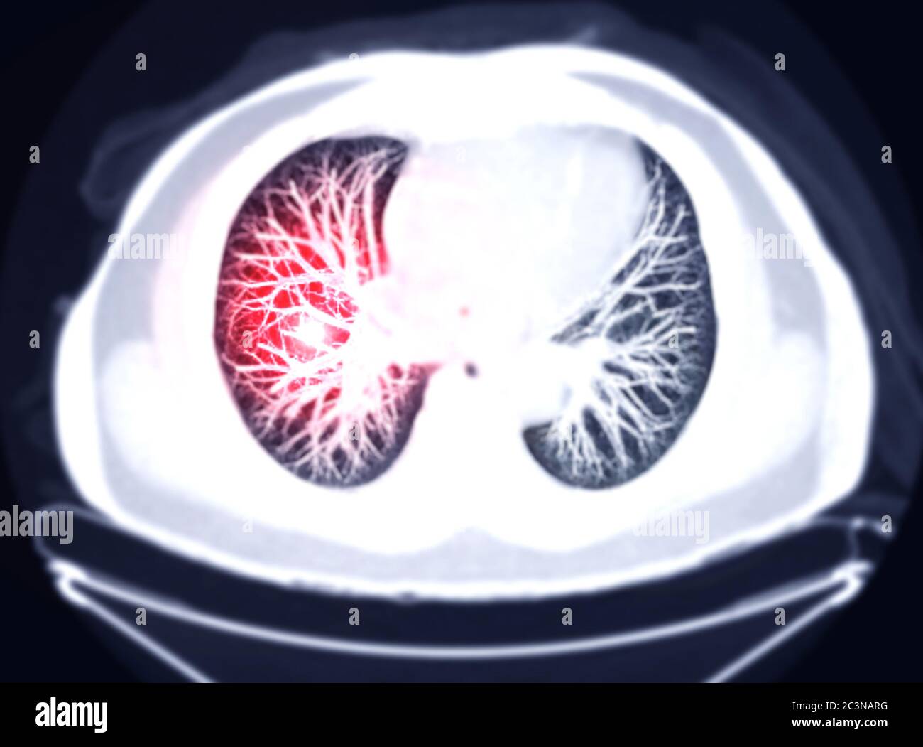 3d renderung anatomie -Fotos und -Bildmaterial in hoher Auflösung - Seite 3 - Alamy