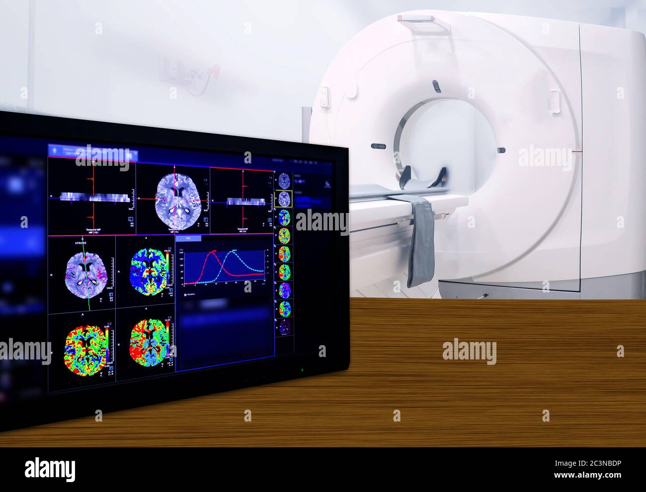 Computertomographie hirninfarkt -Fotos und -Bildmaterial in hoher Auflösung – Alamy