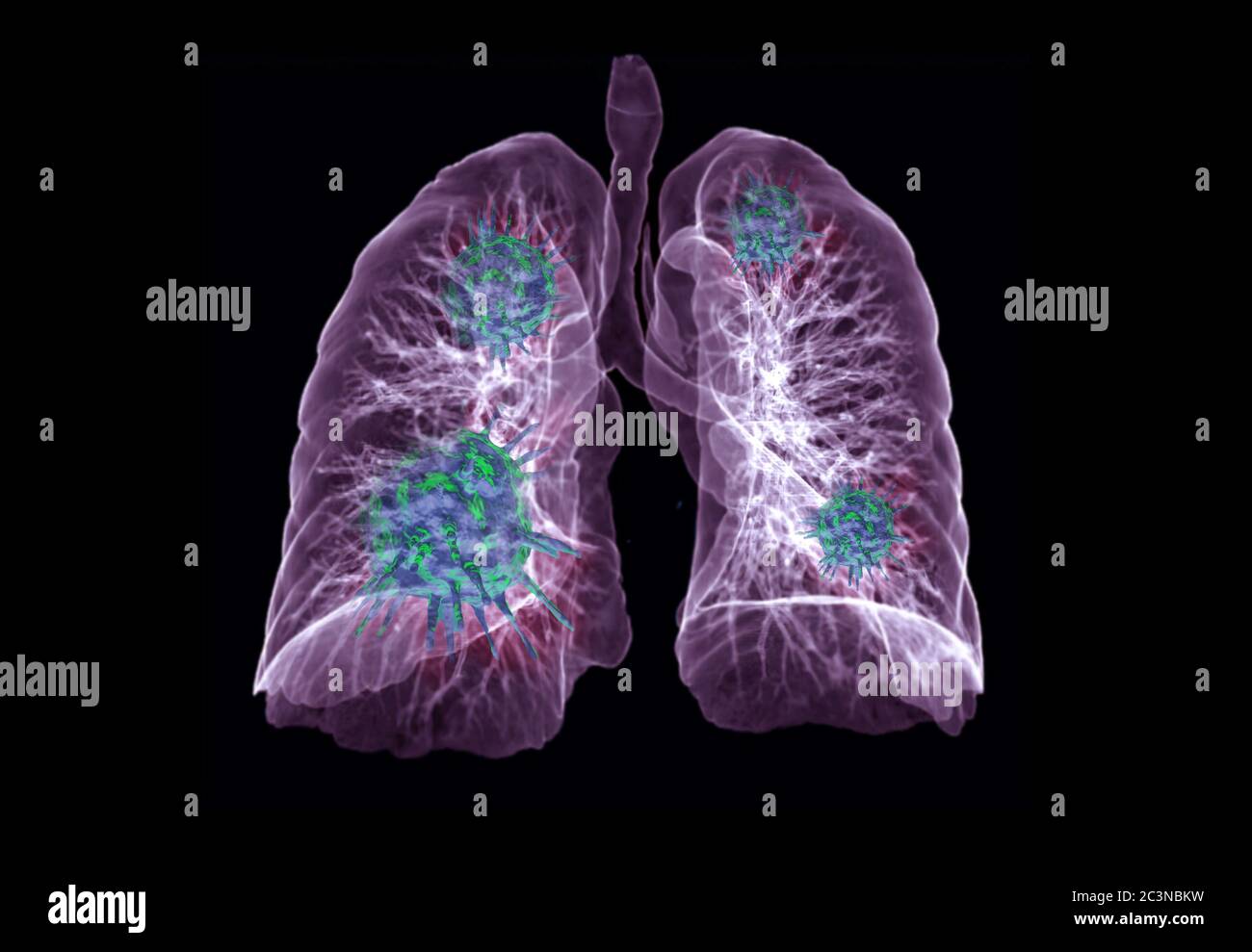 Tuberkulose screening -Fotos und -Bildmaterial in hoher Auflösung – Alamy