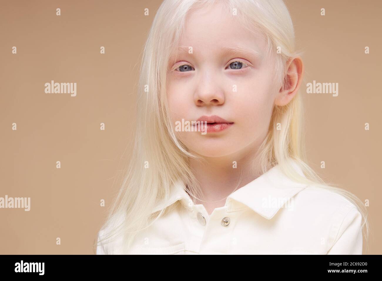 Portrait von Albino Kind Mädchen mit weißer Haut und weißen Haaren ...