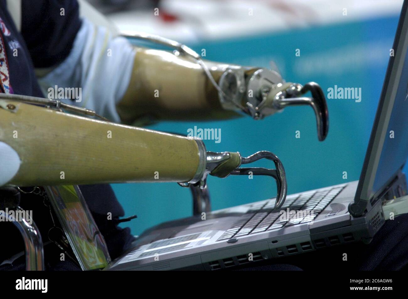 Hands amputated -Fotos und -Bildmaterial in hoher Auflösung – Alamy