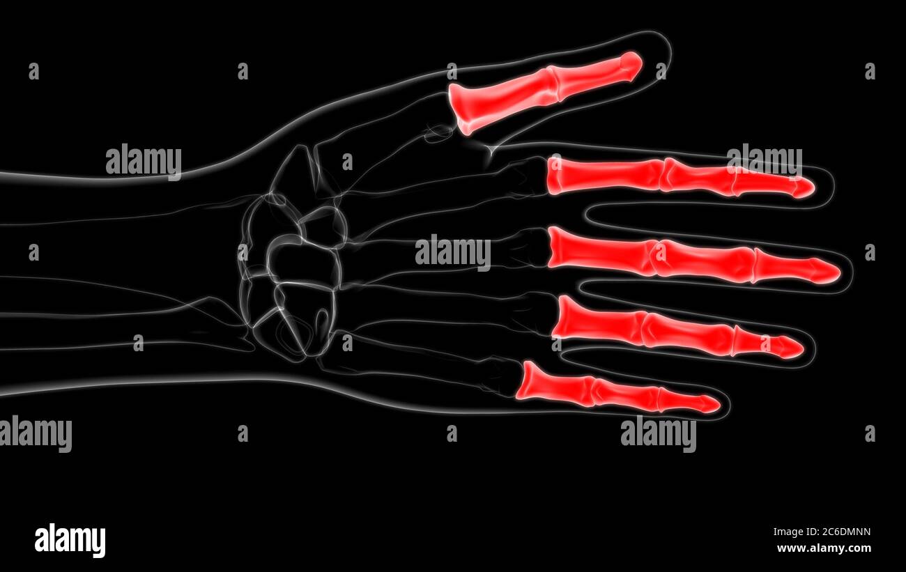 Menschliche Skelett Hand Phalanges Knochen Anatomie für medizinisches ...