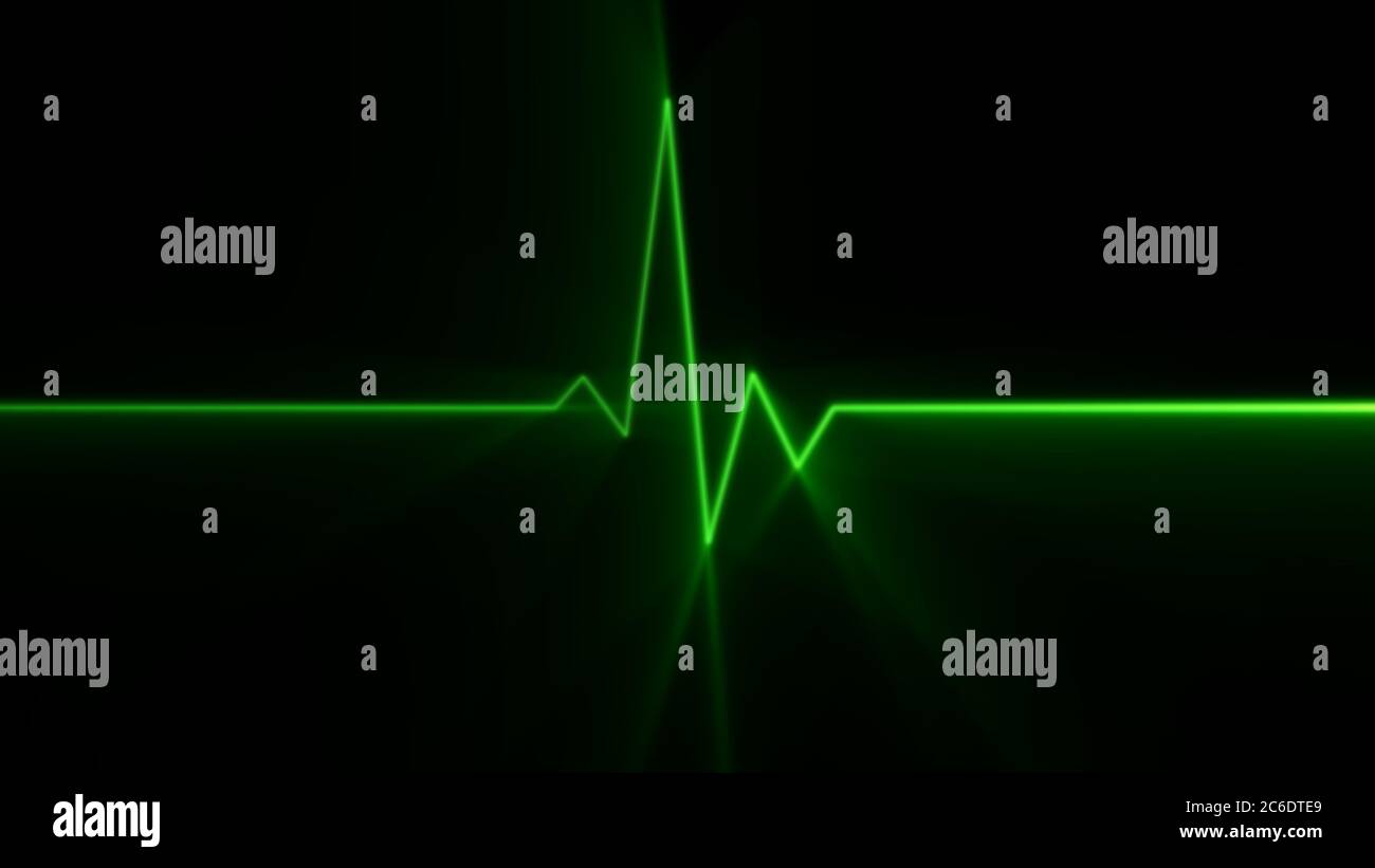 Ekg diagramm -Fotos und -Bildmaterial in hoher Auflösung – Alamy