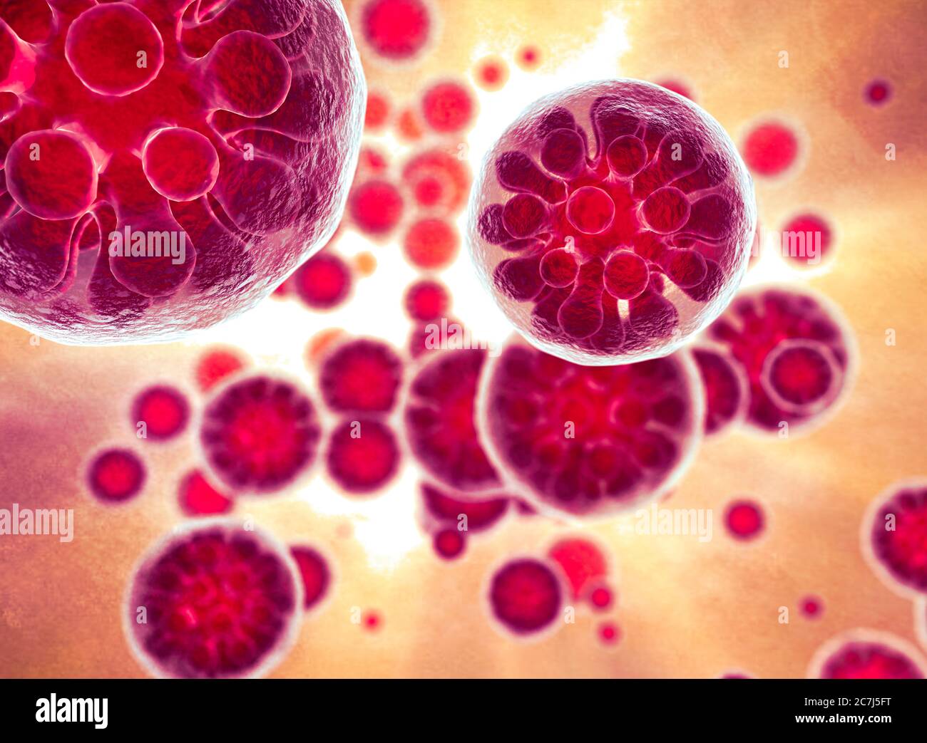 Histoplasmosis capsulatum histoplasma capsulatum -Fotos und ...