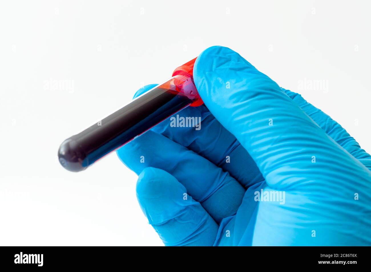 Blutanalyse, klinische oder medizinische Tests und Phlebotomie Konzept ...