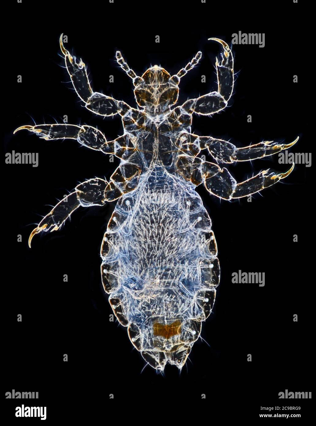 Pediculus capitis -Fotos und -Bildmaterial in hoher Auflösung – Alamy